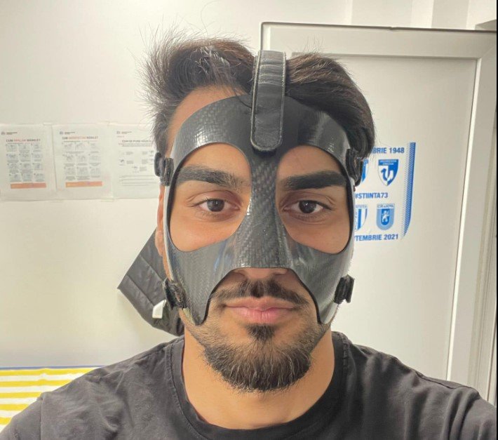 Ștefan Baiaram a primit verdictul. Cât va juca cu mască după ciocnirea ...